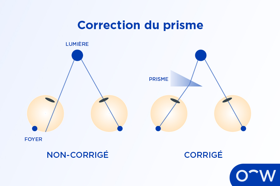 Les lunettes à prisme : définition, usages et effets secondaires