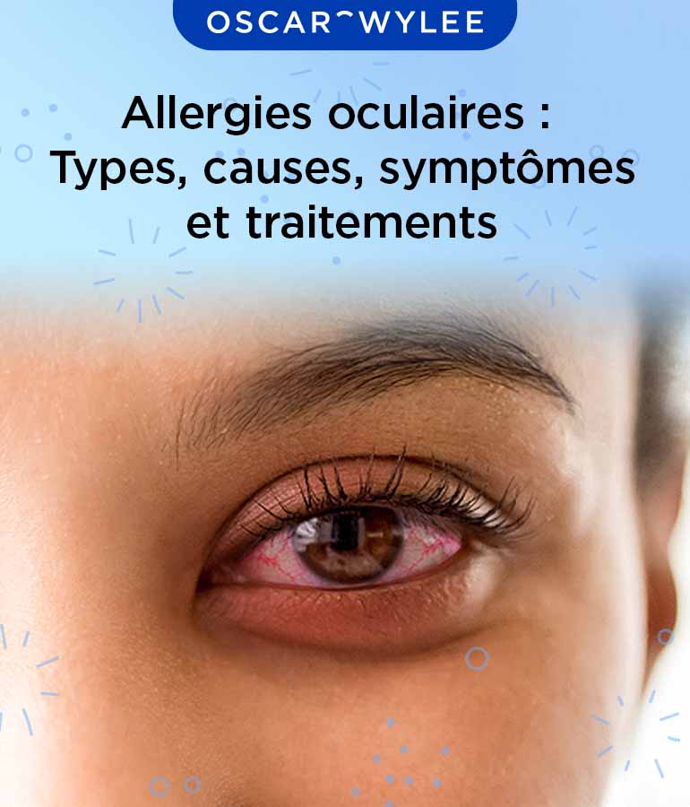 Allergies oculaires : Types, causes, symptômes et traitements