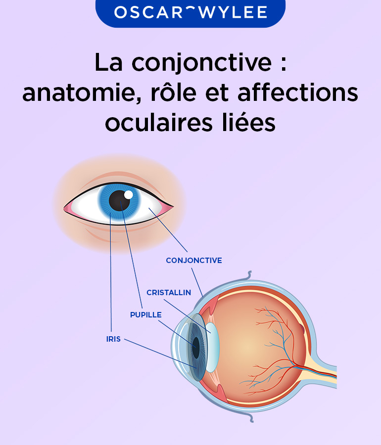 La conjonctive : anatomie, rôle et affections oculaires liées