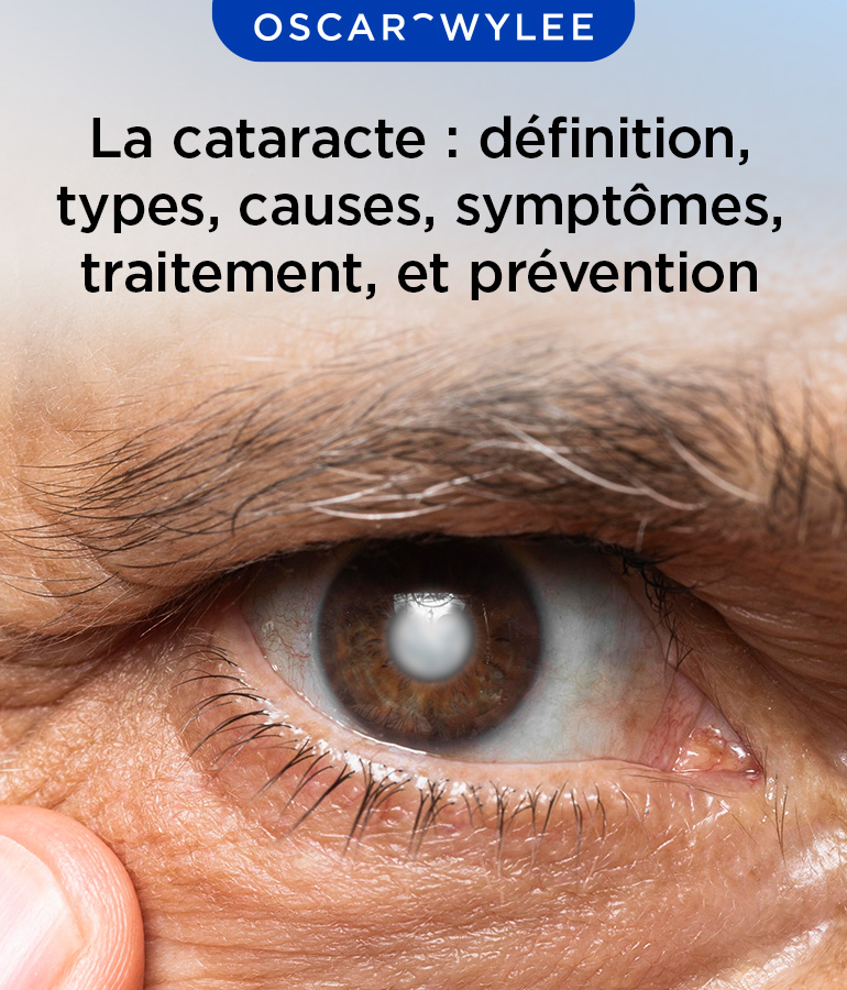 La cataracte : définition, types, causes, symptômes, traitement, et prévention