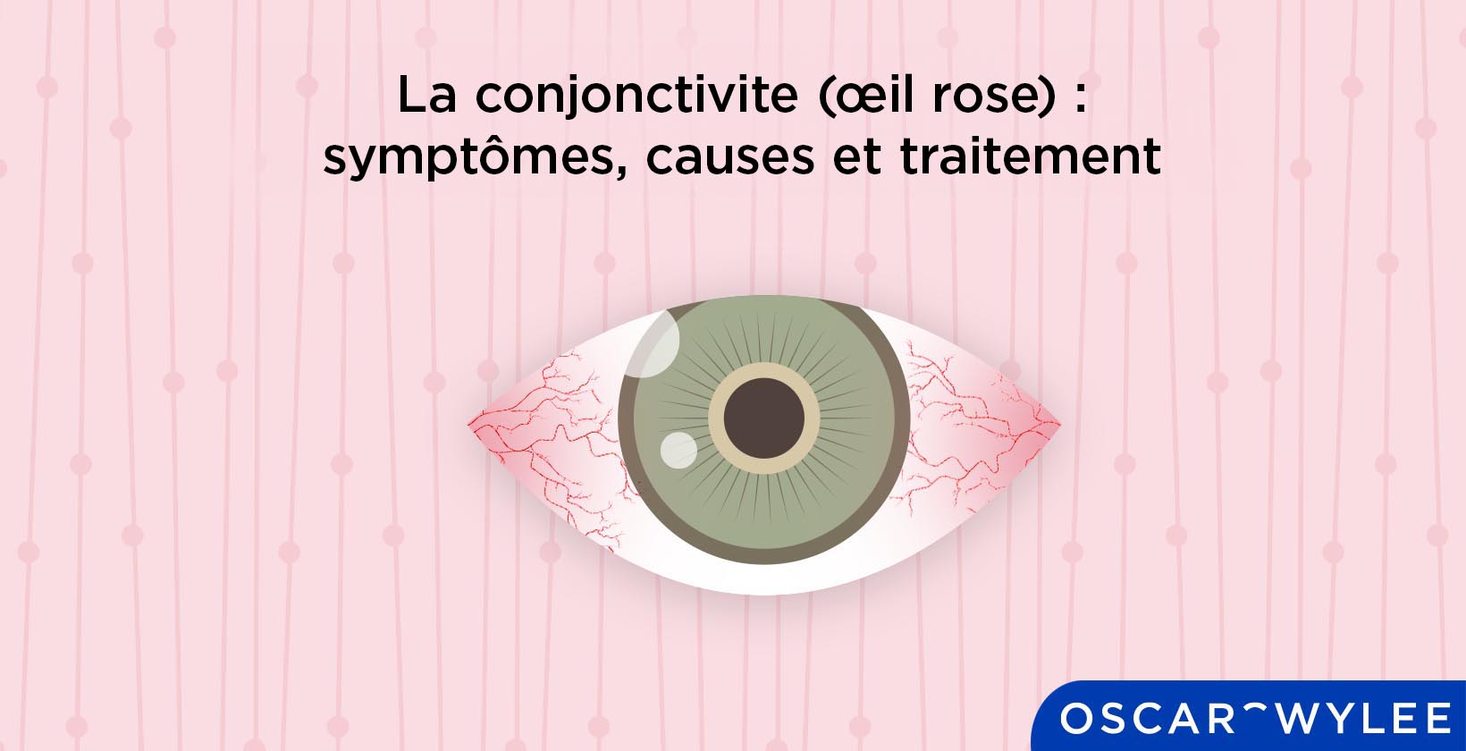 La conjonctivite (œil rose) : symptômes, causes et traitement