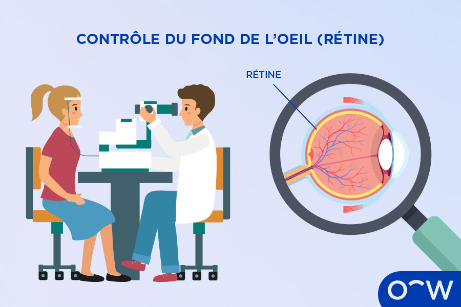 L’examen de la rétine : importance, déroulement et avantages