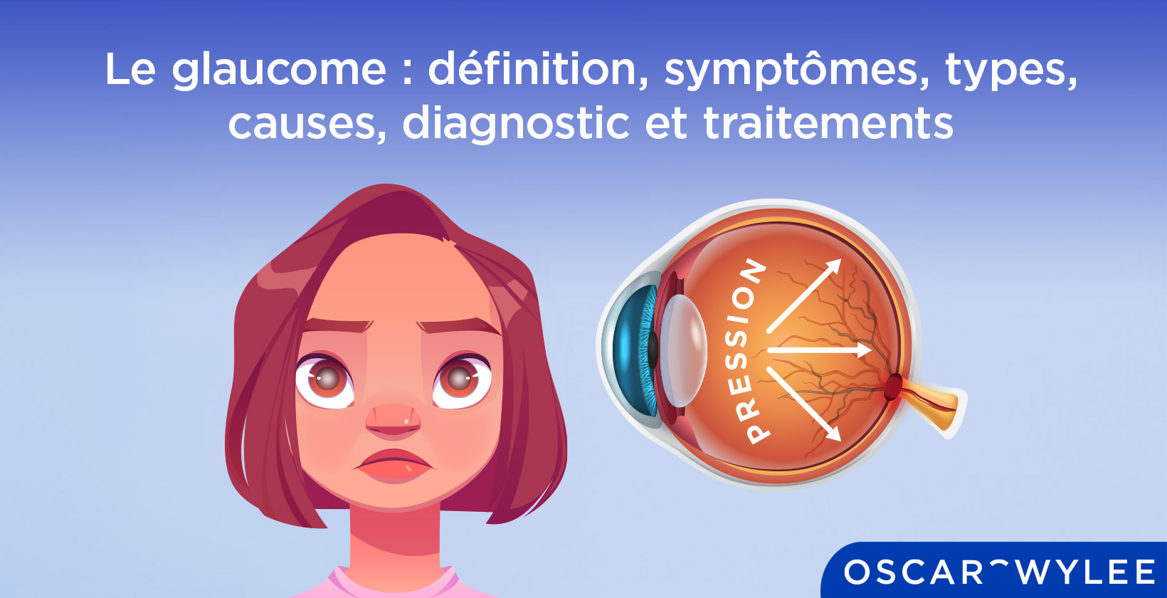 Le glaucome : définition, symptômes, types, causes, diagnostic et ...