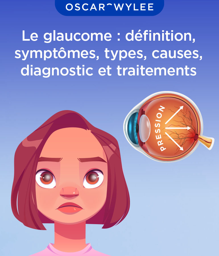 Le glaucome : définition, symptômes, types, causes, diagnostic et traitements