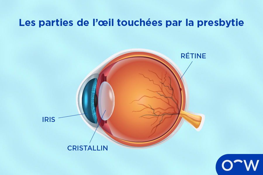 La presbytie : définition, causes, symptômes, diagnostic et traitement