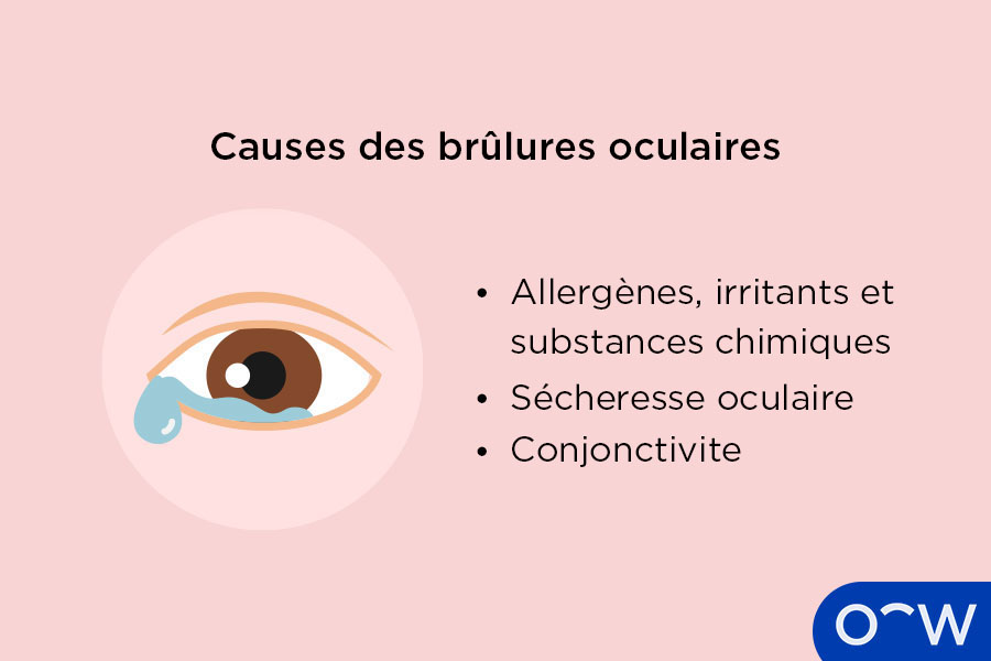 Que faire en cas de brûlure oculaire : mesures immédiates et traitement