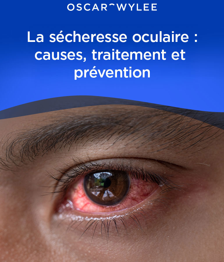La sécheresse oculaire : causes, traitement et prévention