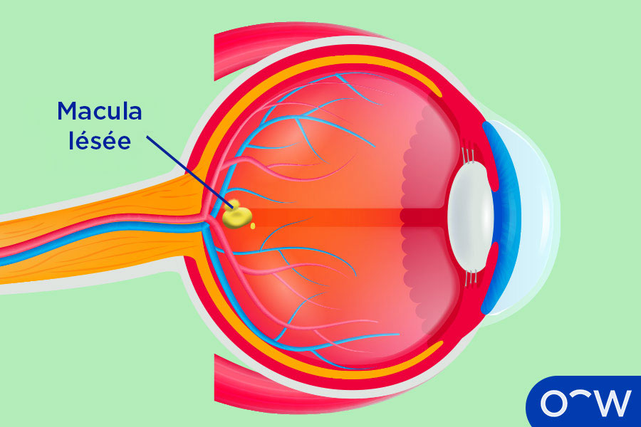Les 25 problèmes oculaires les plus courants