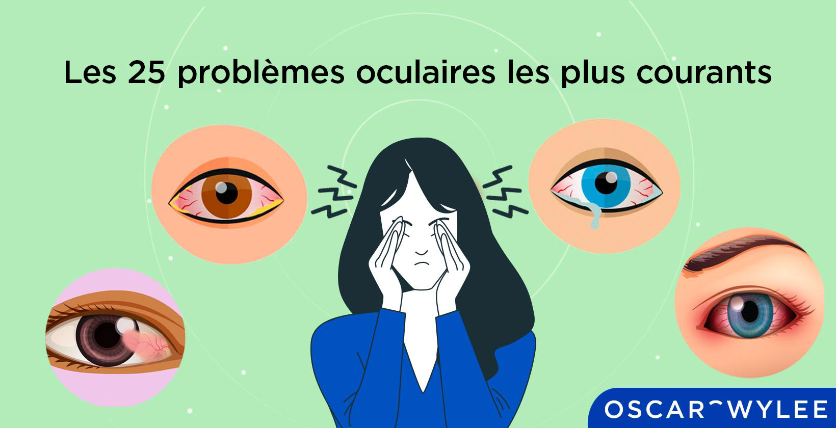 Les 25 problèmes oculaires les plus courants