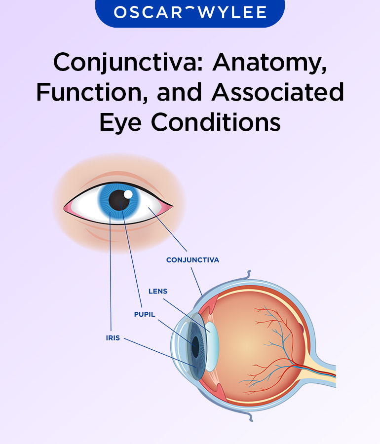 Conjunctiva: Anatomy, Regions, Function, and Associated Eye Conditions
