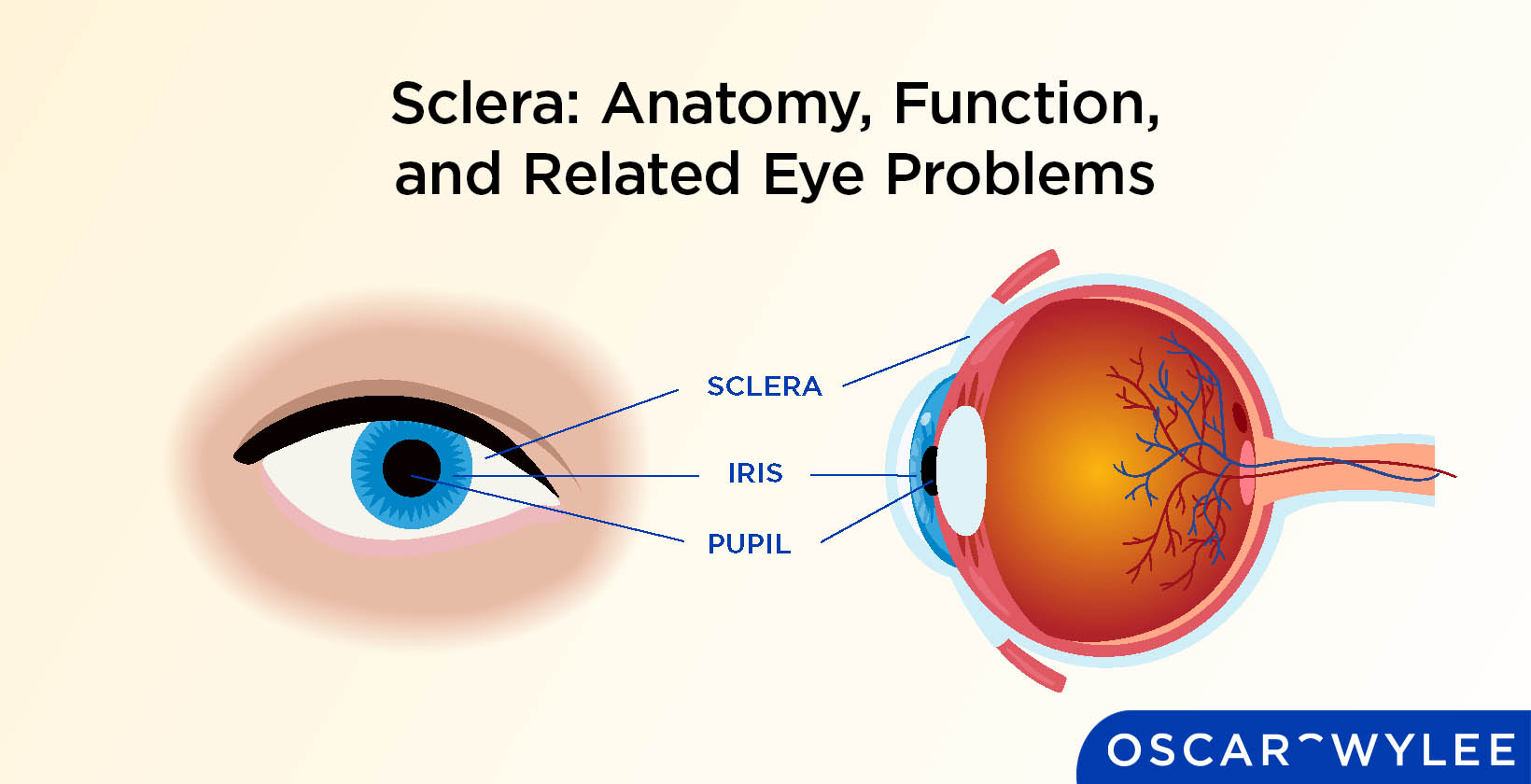 Sclera: Anatomy, Function, and Related Eye Problems