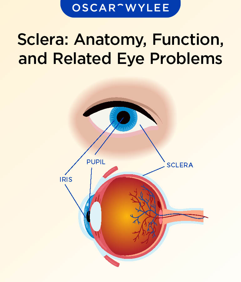 Sclera: Anatomy, Function, and Related Eye Problems
