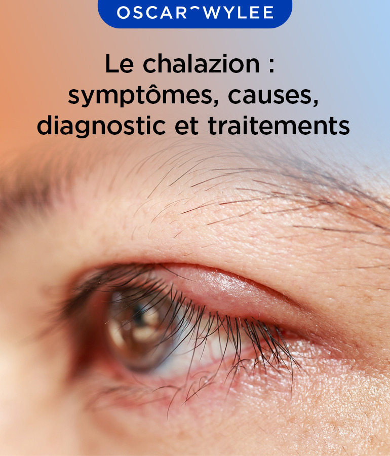 Chalazion : Symptômes, causes, diagnostic et traitements