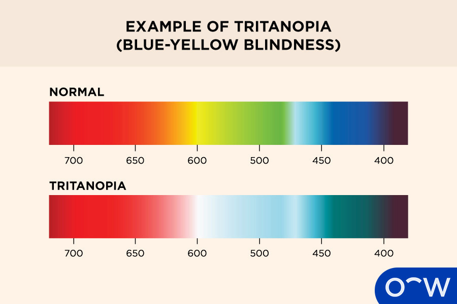 A Comprehensive Guide to Different Types of Color Blindness