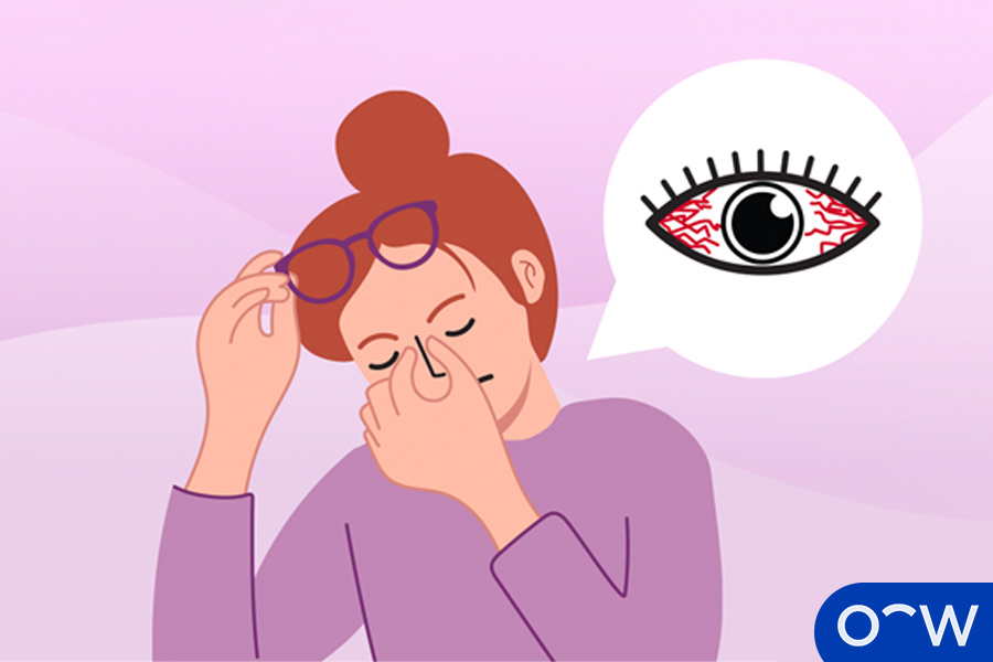 Top 25 Common Eye Problems