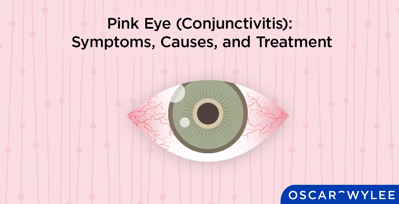 Pink Eye (Conjunctivitis): Symptoms, Causes, and Treatment