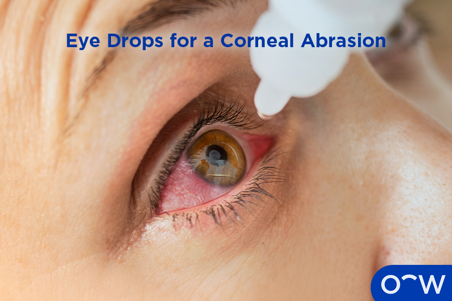 Corneal Abrasion: Causes, Symptoms, Diagnosis, and Treatment