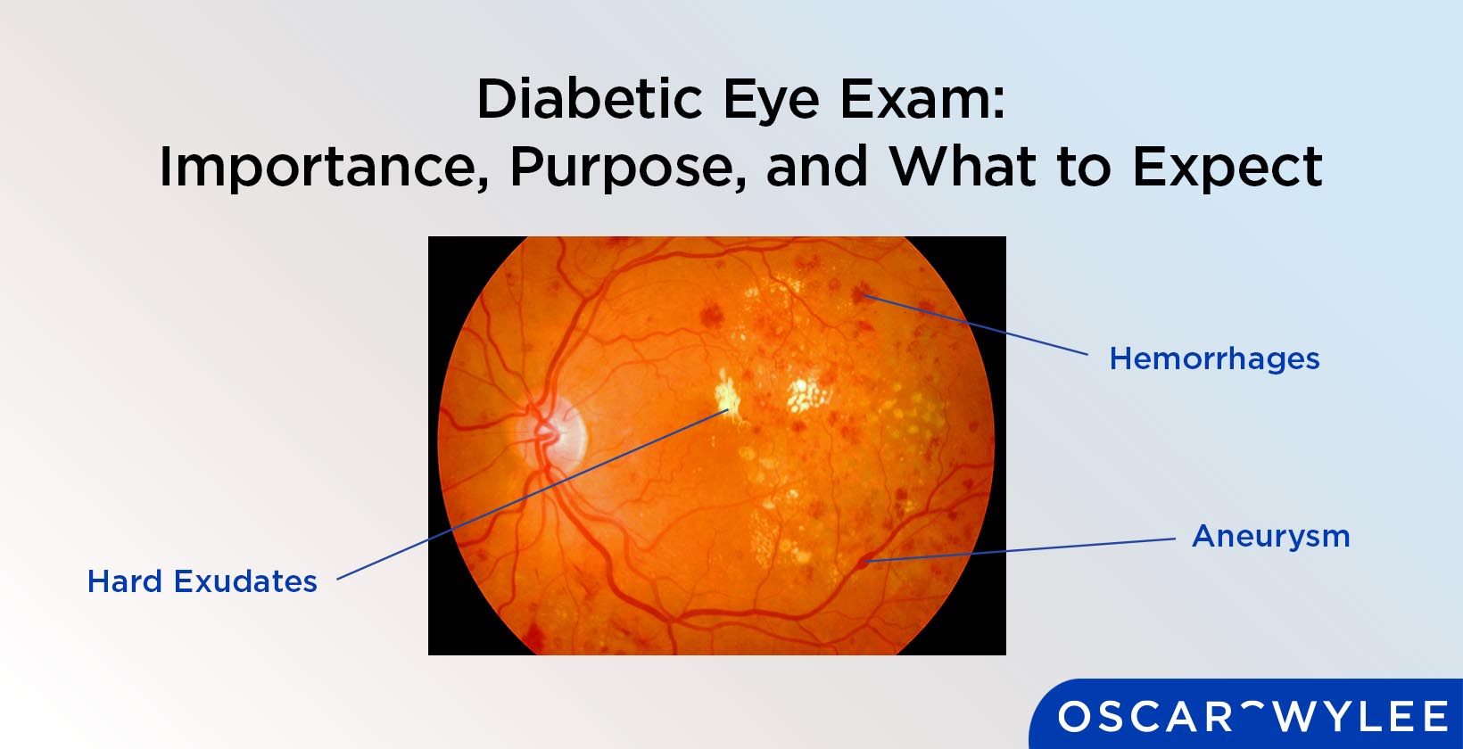 Diabetic Eye Exam: Importance, Purpose, and What to Expect