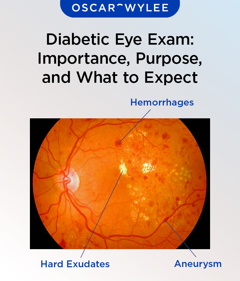 Diabetic Eye Exam: Importance, Purpose, and What to Expect