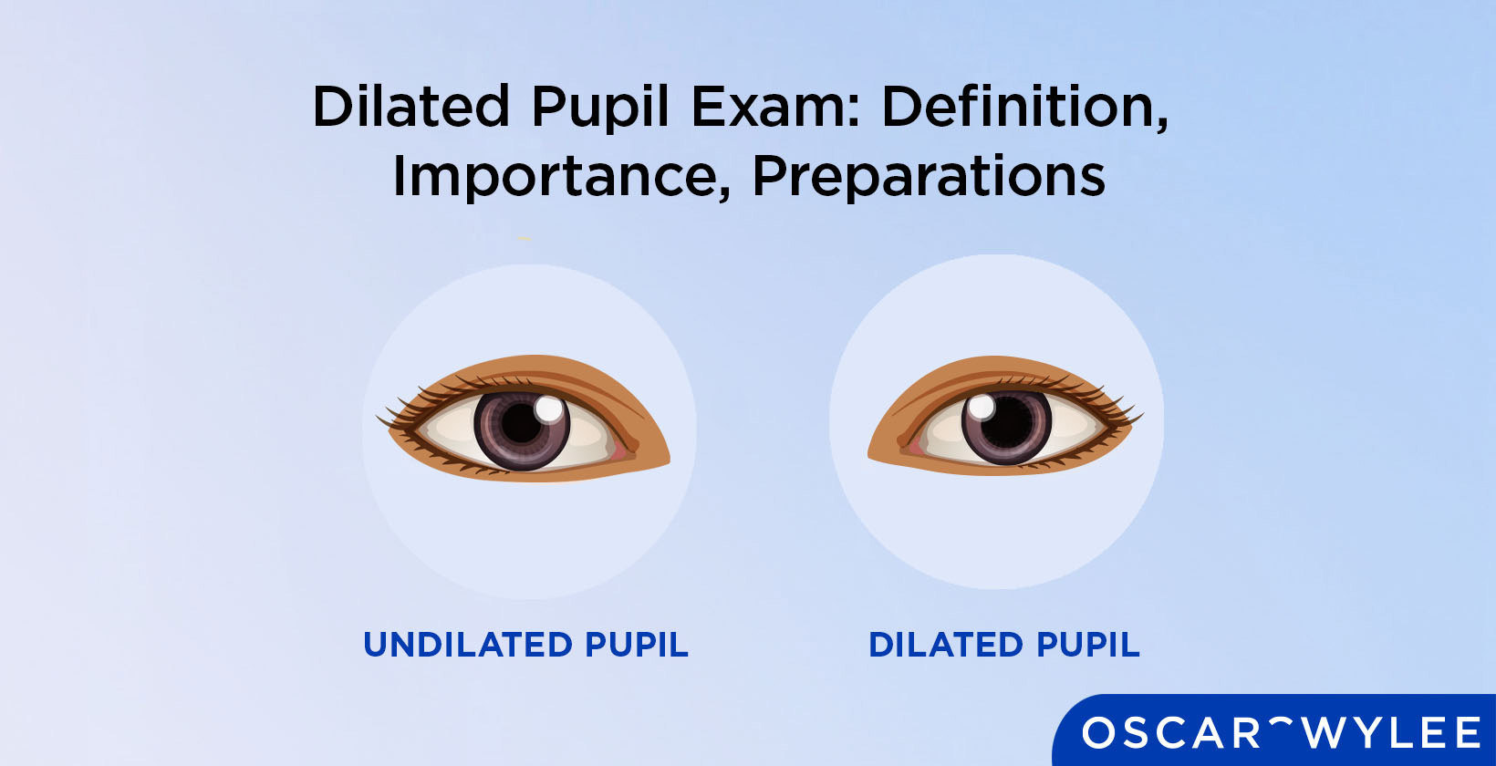 Dilated Pupil Exam: Definition, Importance, Preparations