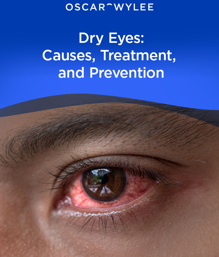 Dry Eyes: Cause, Treatment, and Prevention