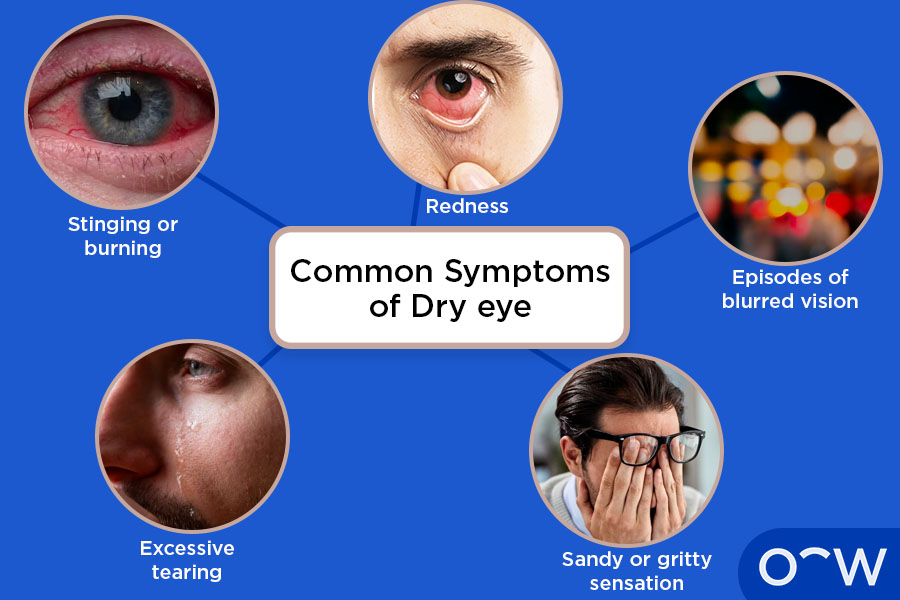 Dry Eyes: Cause, Treatment, and Prevention