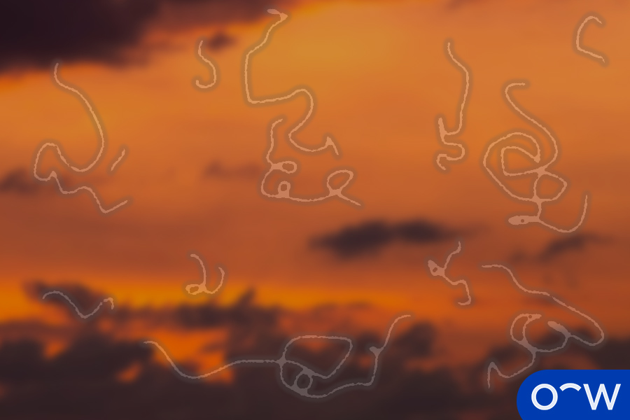 Mouches volantes : Définition, causes, symptômes et traitement