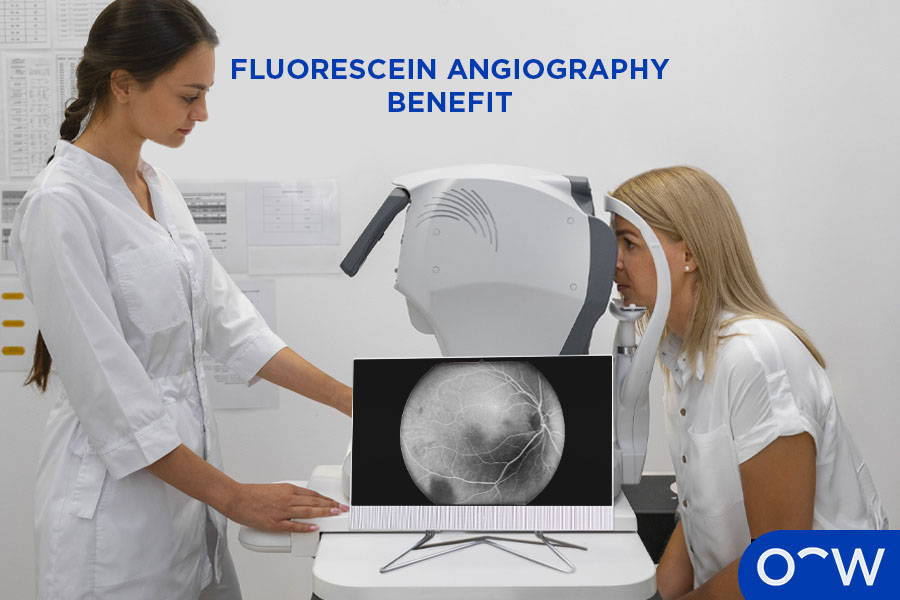 Fluorescein Angiography: Side Effects, Procedure, Risk and Benefits