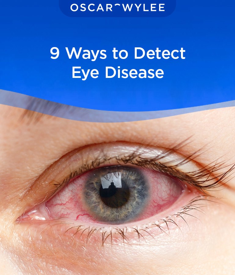 9 Ways to Detect Eye Disease