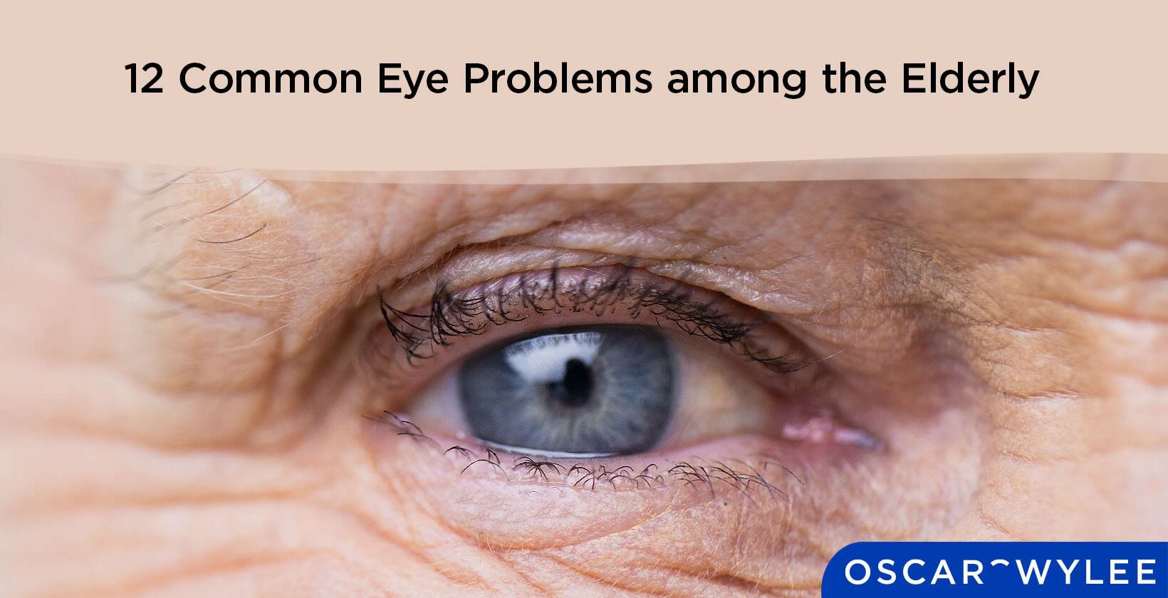 12 Common Eye Problems among the Elderly