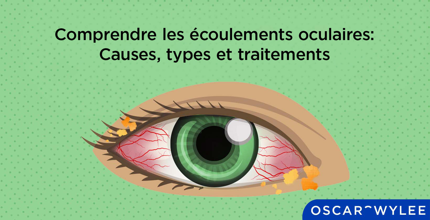 Comprendre les écoulements oculaires : causes, types et traitements