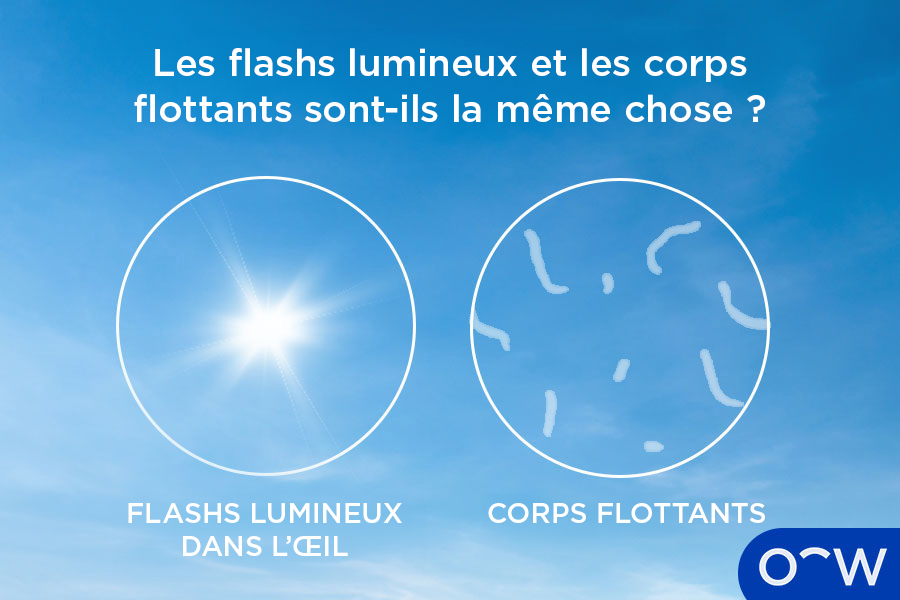 Flashs lumineux au coin de l’œil : origine, causes et traitement
