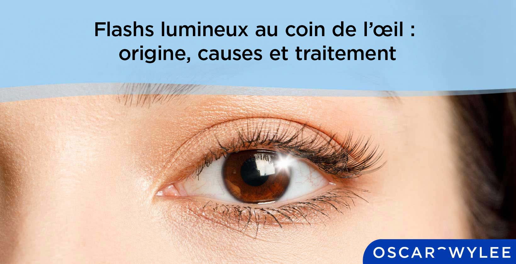 Flashs lumineux au coin de l’œil : origine, causes et traitement
